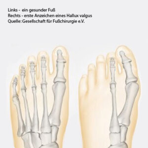 Experten für Fußchirurgie und Sprunggelenkchirurgie